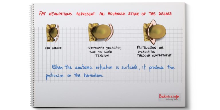 image Copeman 1947 herniations as stage | backmice.info