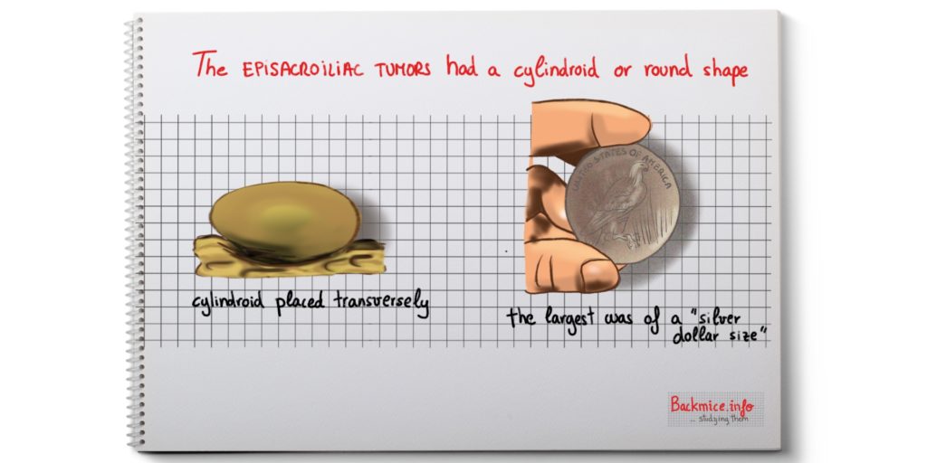 Episacroiliac lipoma (or back mice) | backmice.info