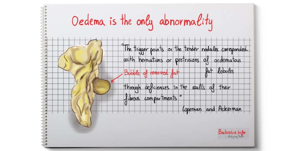 image copeman 1947 oedema bubble | backmice.info