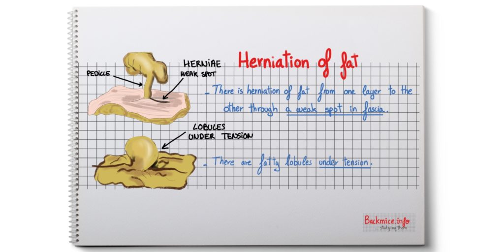 Fibrositis of the back (or back mice) | backmice.info