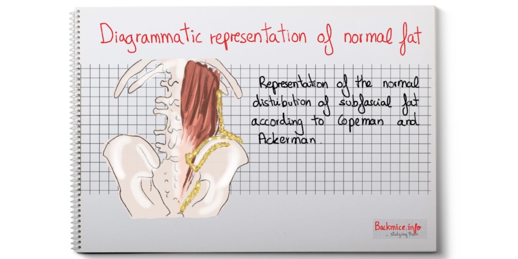 Herniation of fascial fat and low back pain | backmice.info