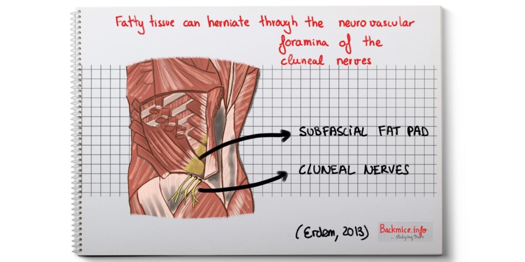 Episacral lipoma: a treatable cause of low back pain (low back fatty ...