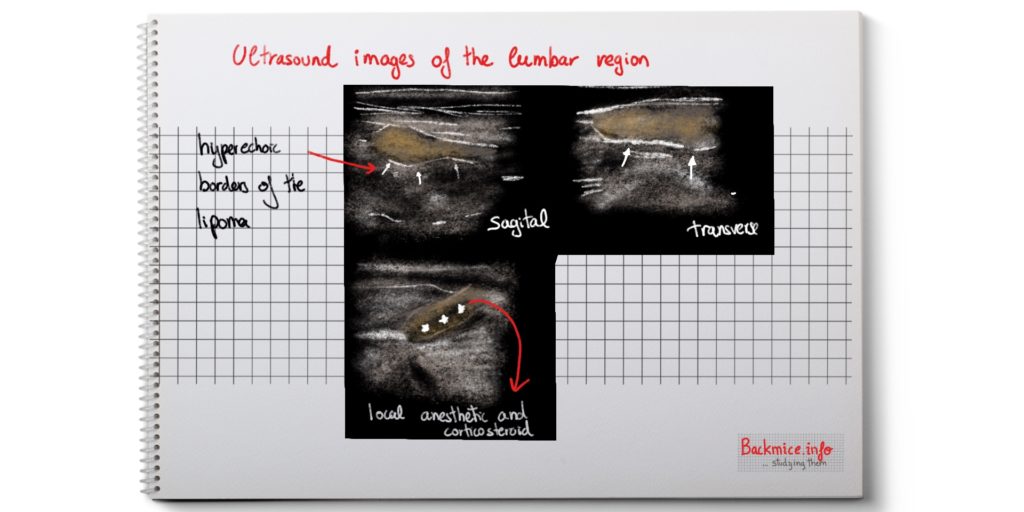 The Best-Laid Plans of "Back Mice" and Men: A Case Report and ...