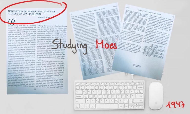 Articles about nodules and trigger points. Low back pain. ("Back mice ...